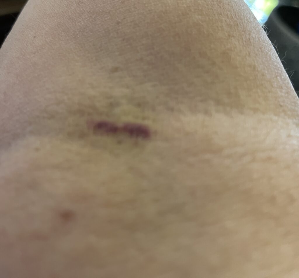 Aging Skin - Graceful Aging Center